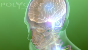 Polygon Medical Animation – Brain Signalling | Jensen Learning | Brain ...