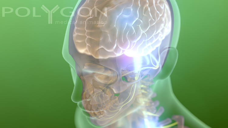 Polygon Medical Animation – Brain Signalling | Jensen Learning | Brain ...